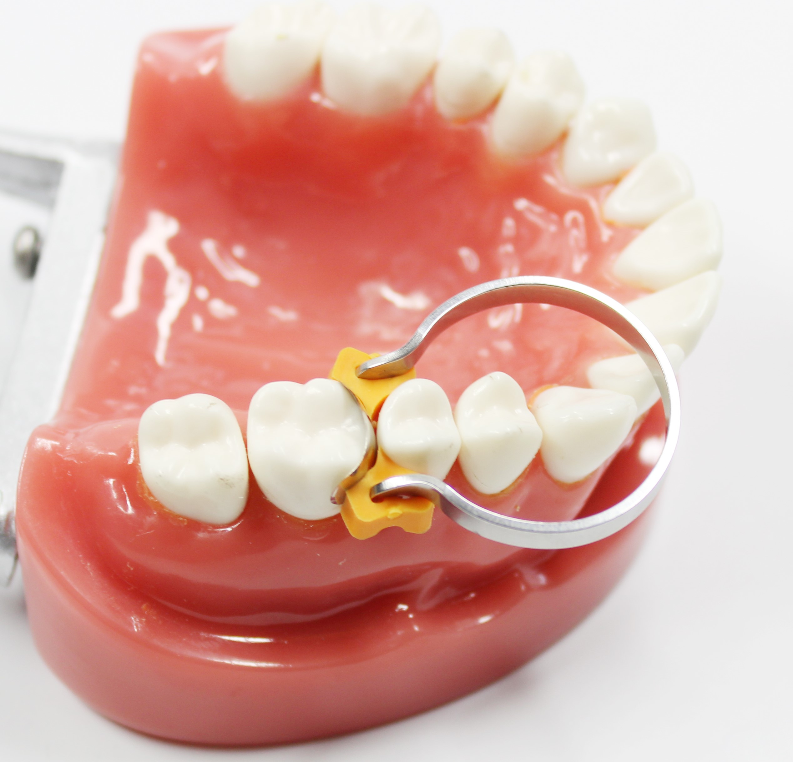 Clamping Ring – Dsndental.se